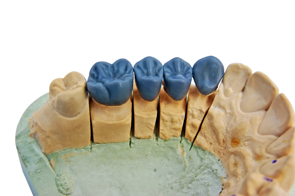 Trimming the Incisal Edge Guide | Spear Education