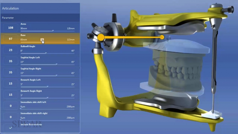 Evolution of the Virtual Articulator | Spear Education