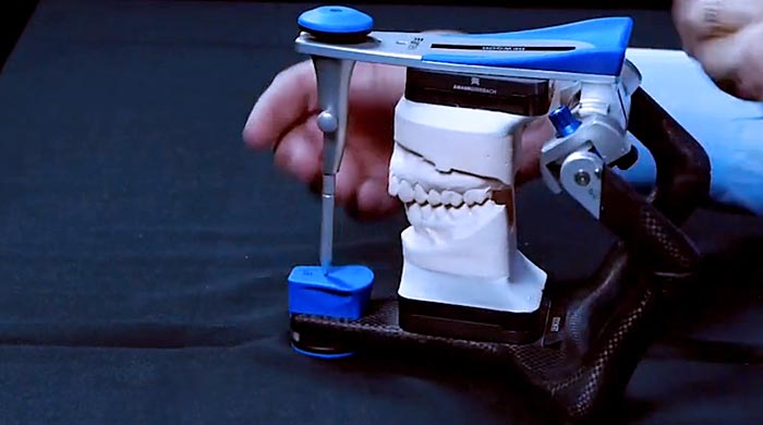 The Artex Facebow | Spear Education