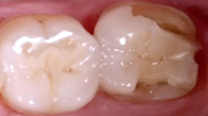 Vertical Dimension Considerations | Spear Education